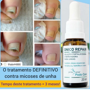 Onico Repair Podo Care - Prime Sense 20ml | Shopee Brasil