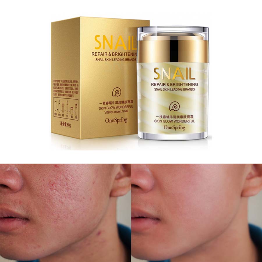 Creme Baba De Caracol Age Contra E Acne Sinais De Idade | Shopee Brasil