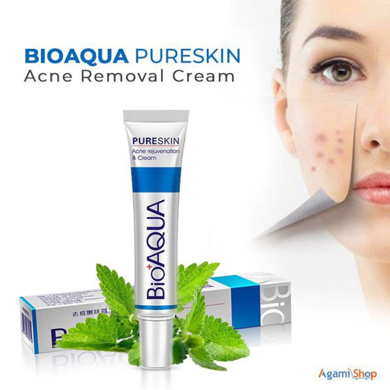 Creme Bioaqua Pure Skin | Para Acne Espinhas Cravos Manchas E Melasma ...