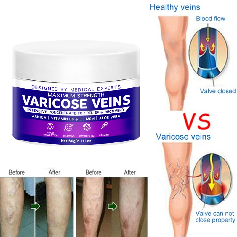 O Diretor De Cirurgia Vascular Recomenda Fortemente-2021 Últimas ...