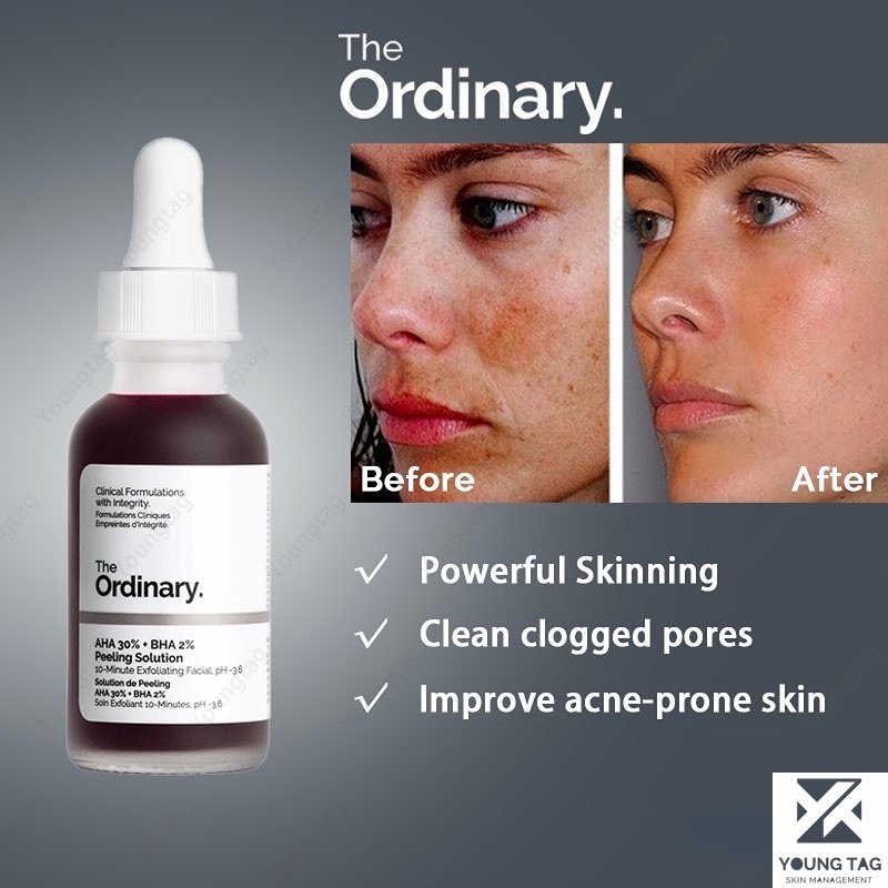 100% Original The Ordinary AHA 30% + BHA 2% Peeling Solution 30ml | Shopee Brasil
