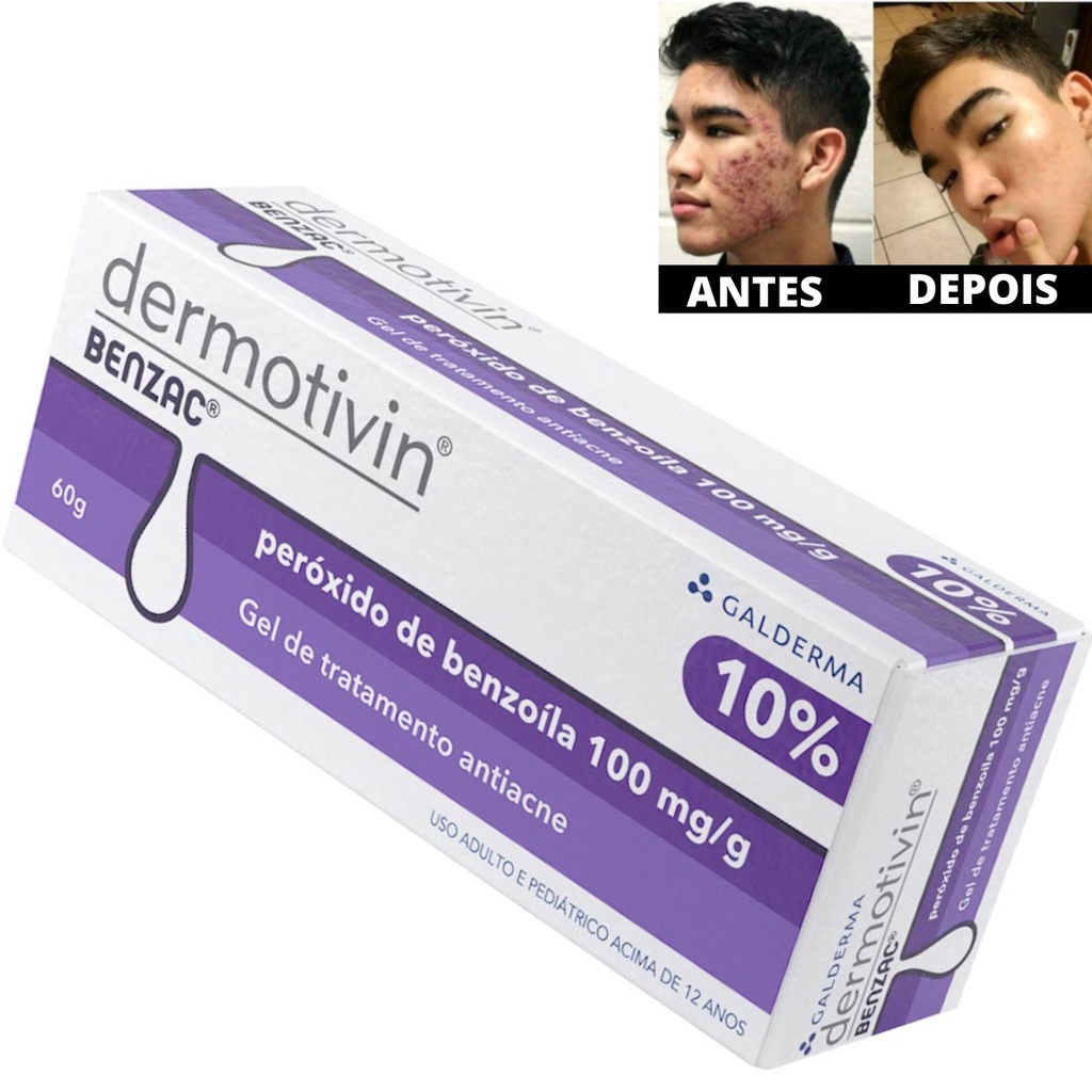 Pomada Para Espinha E Cravo Benzac Ac 100mg/g Benzac Peróxido De Benzoíla Acne Espinha | Shopee ...