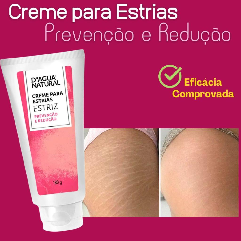 Creme De Massagem Antiestrias Para O Corpo Previne Estrias Hidratação ...