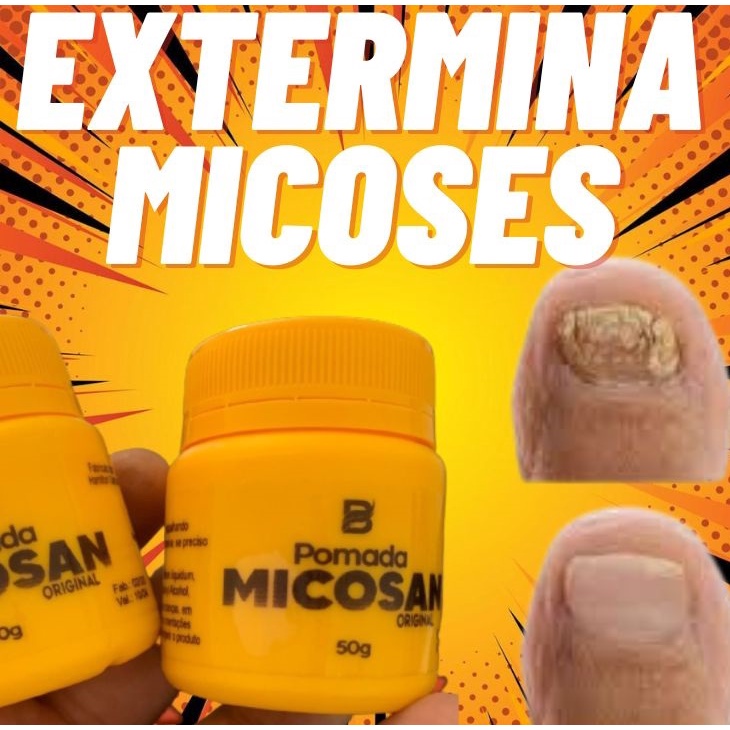 Pomada Milagrosa Curadoraa Exterminador de Unheiro Fungos Micoses Unhas ...