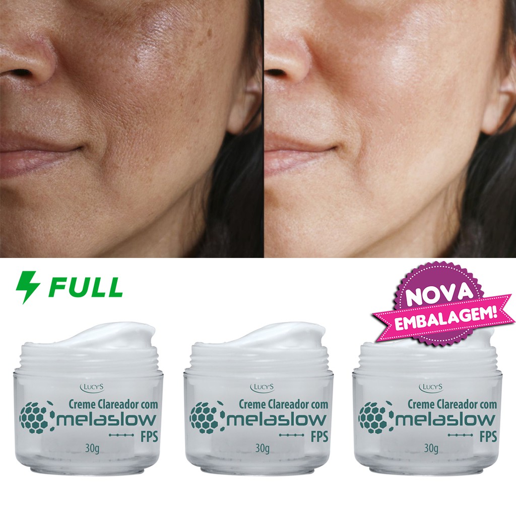 Kit 3 Cremes Melaslow para Clarear Manchas Escuras de Sol Acne Melasma Sardas Gravidez 30g ...