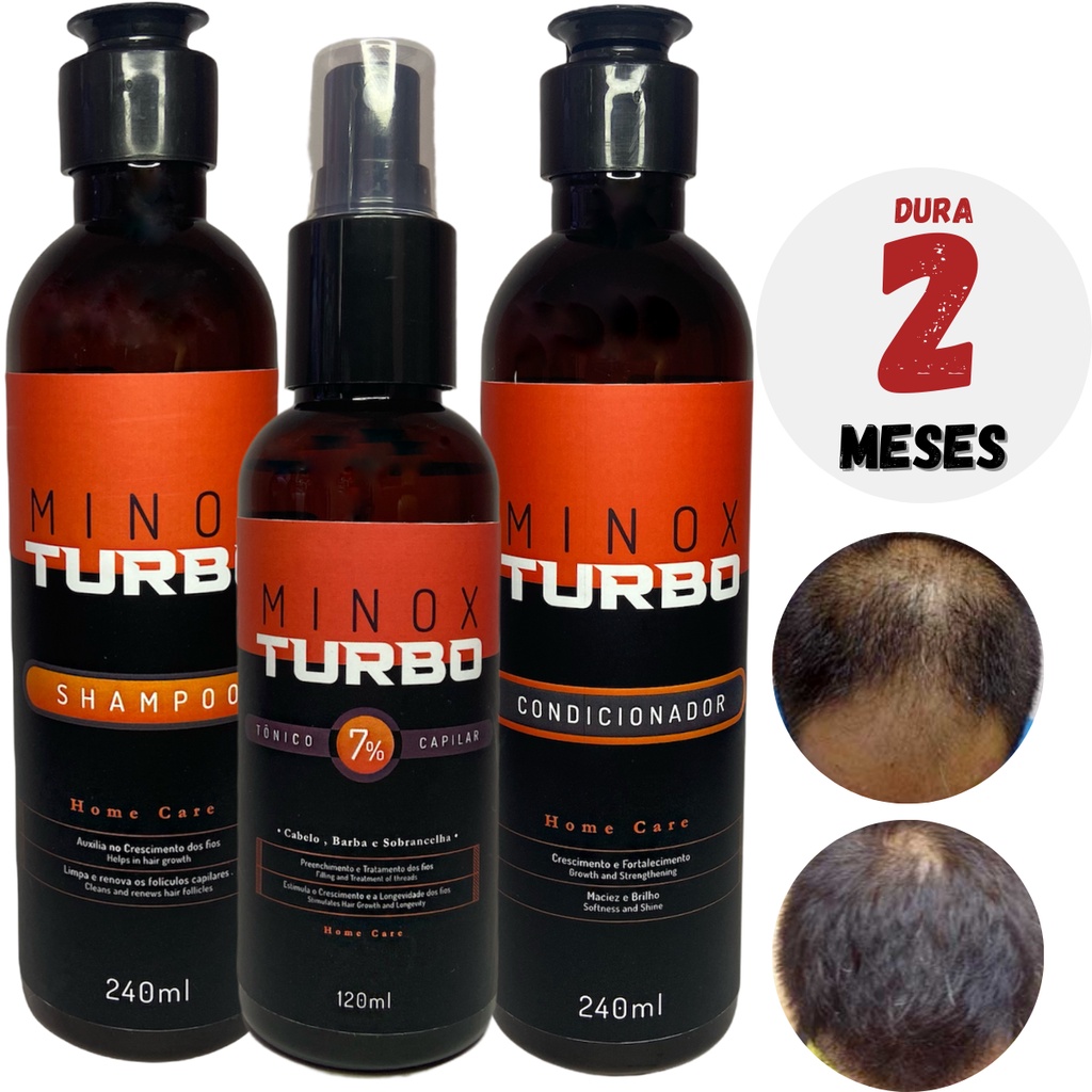 Kit Xampu Cresce Cabelo E Protege da Queda Dos Fios MinoxTurbo | Shopee ...