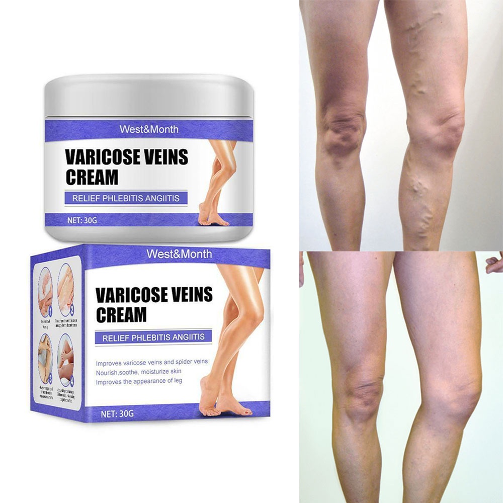 Creme Relaxante Varizes Veias Vasos Pernas Cansadas Shopee Brasil