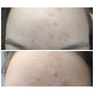 Peeling de algas marinhas do mar morto ORIGINAL | Shopee Brasil