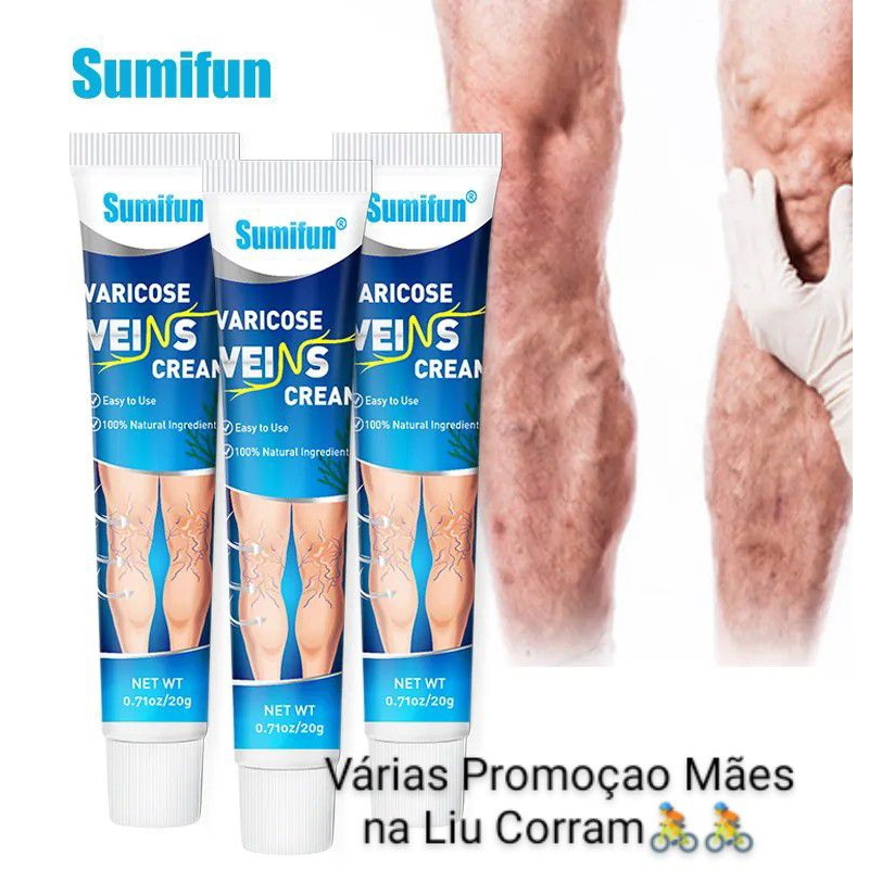 kit 3 Pomadas Varizes Veins Vasinhos Queimação Dores | Shopee Brasil