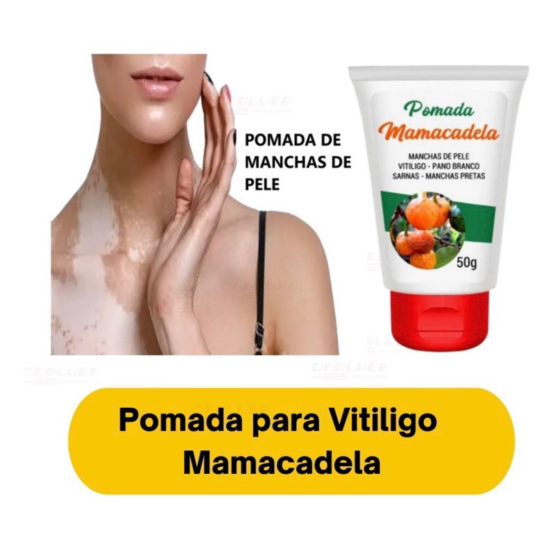 Pomada Mamacadela 50g Original Vitiligo Manchas na pele Envio Imediato ...