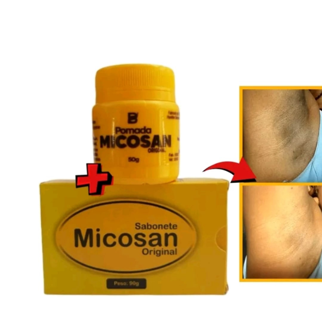 Kit (Com 2 Itens) POMADA Micosan + Sabonete em BARRA Micosan Original ...