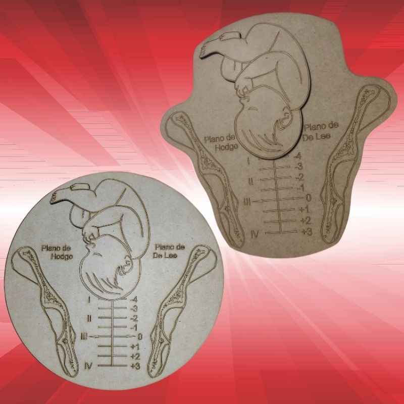 Planos De Hodge Conjugado Verdadeiro Obstétrico E Anatomy IMAIOS