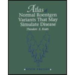 Atlas of Normal Roentgen Variants That May Simulate Disease - Theodore ...