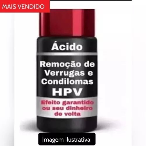 Eliminador de Verrugas mais rapido condiloma HPV | Shopee Brasil