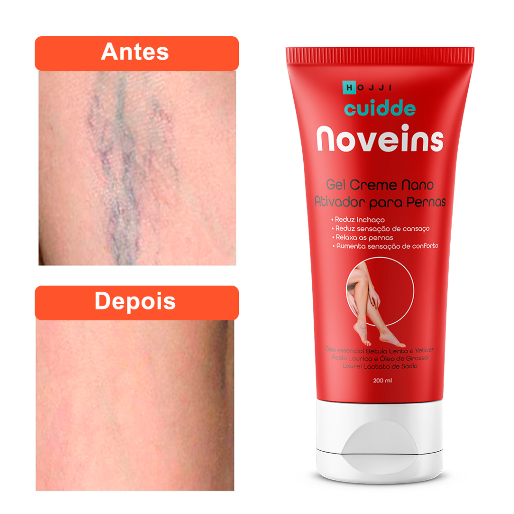 Gel para Varizes c/ 200ml - CUIDDE | Shopee Brasil
