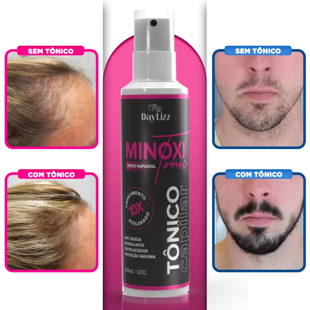 Tônico Capilar Poderoso para Cabelo e Barba | Melhor que Minoxidil ...
