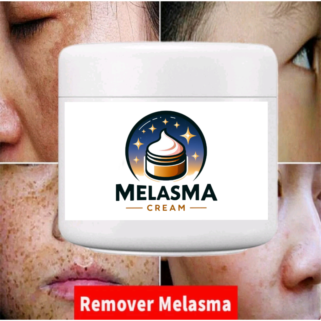 Creme Melasma Remove/Blemishes/Melanina/Clareamento Facial | Shopee Brasil