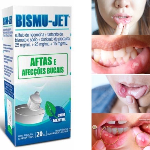 BISMU-JET 20ML AFTAS E FERIDAS NA BOCA | Shopee Brasil