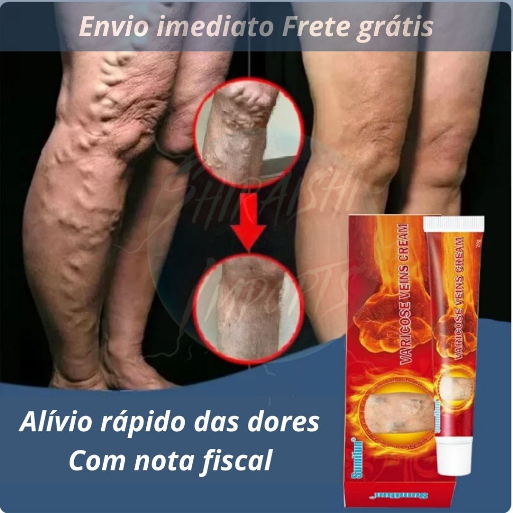 Kit 2 Creme Varizes Pomada Varicose Veins Varizes Veias | Shopee Brasil