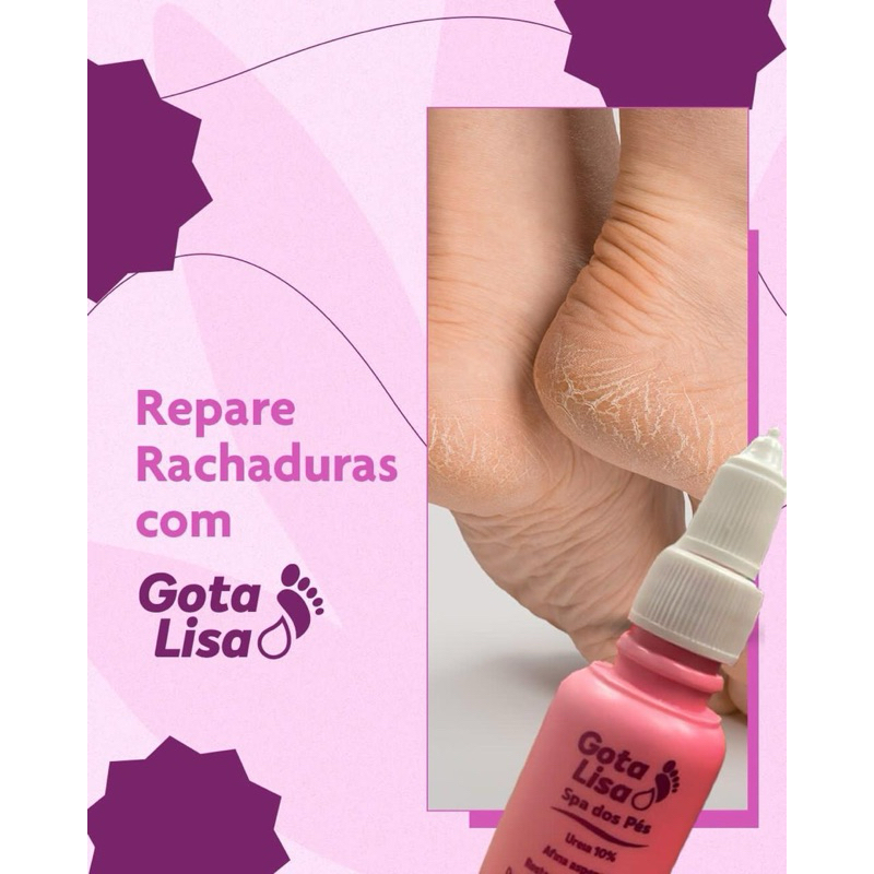 KIT 3 - Gota Lisa para os Pés Contra Rachaduras | Shopee Brasil