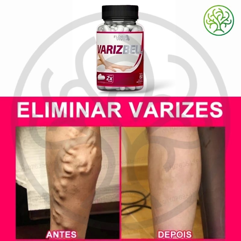 Varizbel Dores Nas Pernas E Varizes Suplemento Alimentar 60 Caps