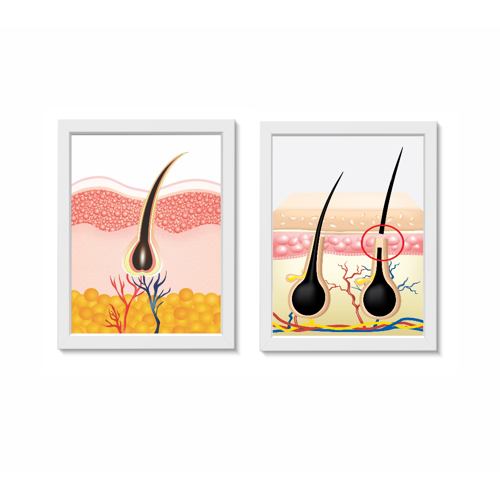 Kit 2 Quadros Anatomia do Pelo Cabelo para Consultório ou Clínica ...