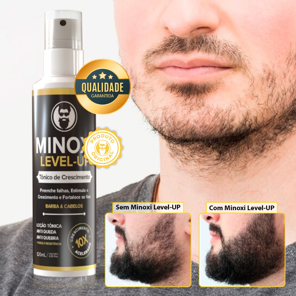 Tônico de Crescimento Super Poderoso Cabelo e Barba - Minox Level Up ...