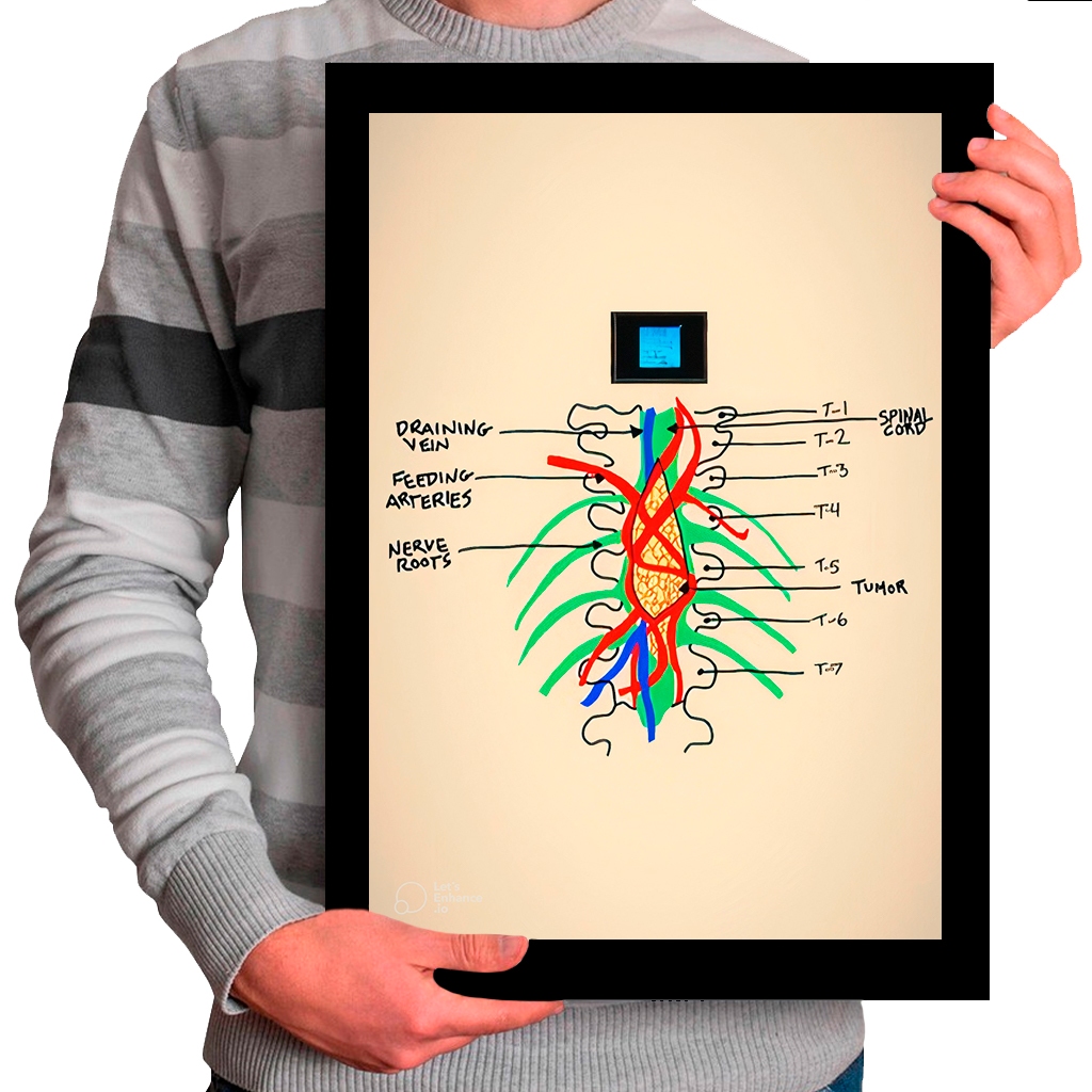 ASIA sales ARGENTO ANATOM A DE UN