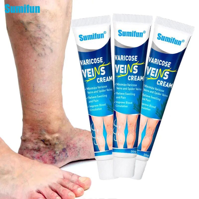 3 Pomadas Veins Varizes Varicoze Dores Sumifun | Shopee Brasil