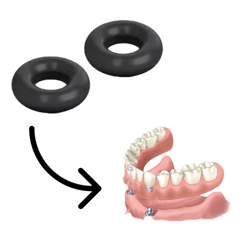 O'ring Overdenture Dentadura 10 Borracha Implante 3.6/4.2mm borrachinha ...