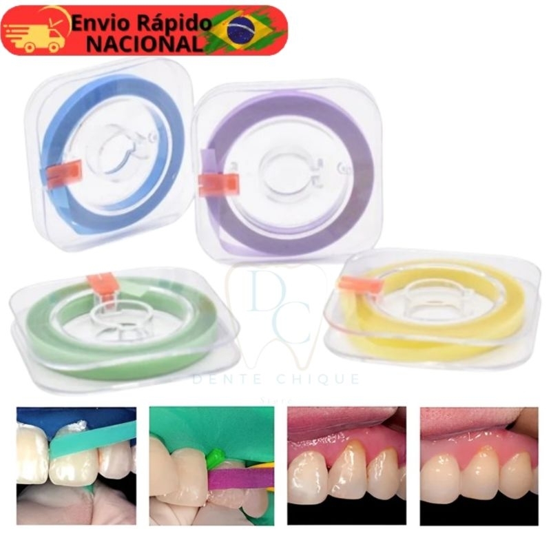 Rolo Fita Lixa para Polimento Interproximal | Shopee Brasil