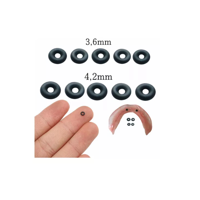 5 O-RING ANEL DE BORRACHA 3,6 DENTADURA OVERDENTURE ODONTO | Shopee Brasil