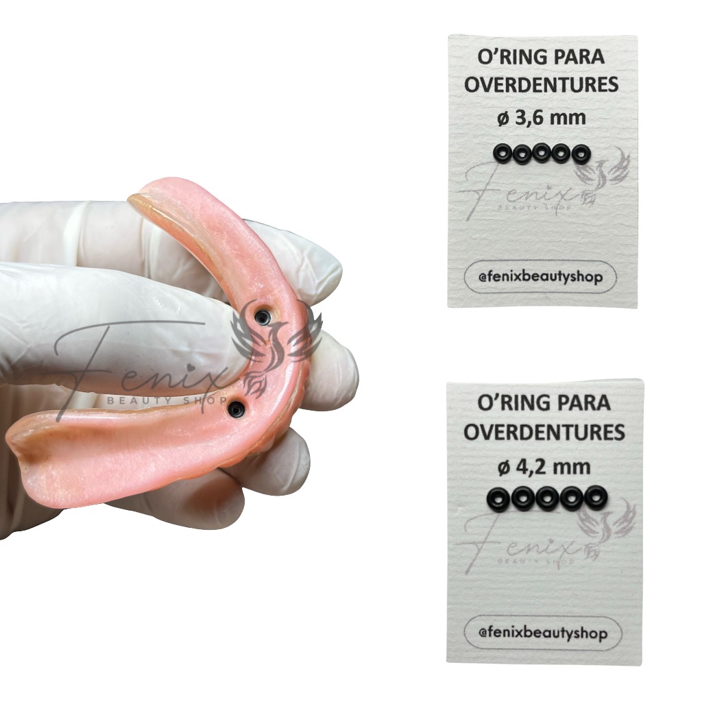 O-RING RETENÇÃO DO IMPLANTE ATTACHMENT BOLA MINI BORRACHINHA ...
