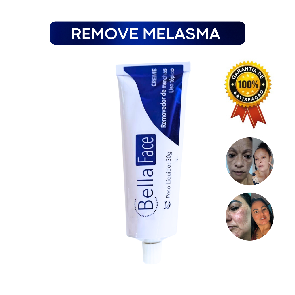 Creme Removedor de Melasma e Manchas da pele Bella Face Original ...