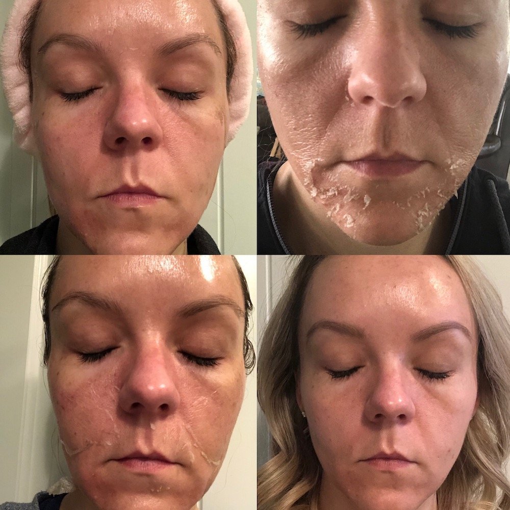 Peeling do Mar Morto Original + Manual (ENVIO RAPIDO) | Shopee Brasil