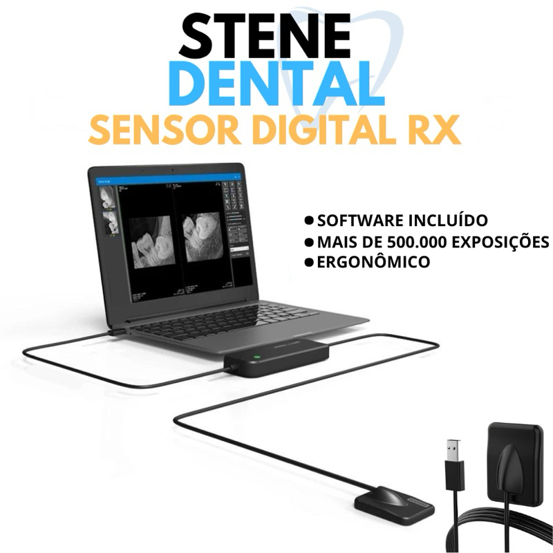 Sensor Digital de Raio-X Intraoral STENE | Shopee Brasil