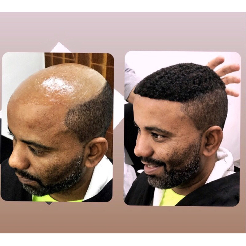 PRÓTESE CAPILAR MASCULINA CABELOS CRESPOS SINTÉTICOS COSTURADOS ...