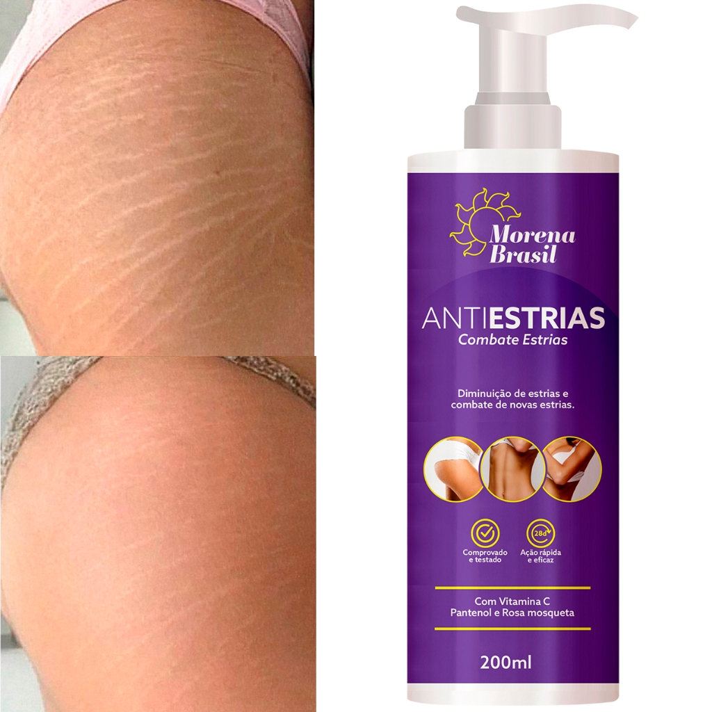 Morena Brasil Creme Anti-Estrias 200g – Elasticidade e Firmeza para sua Pele | Shopee Brasil