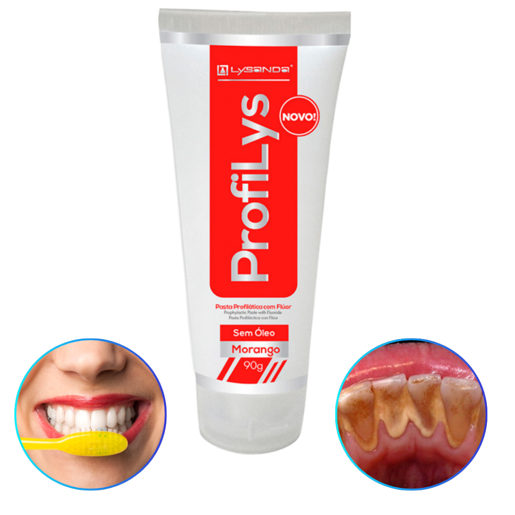 Pasta Profilática Menta Acabamento E Limpeza Dental Morango | Shopee Brasil