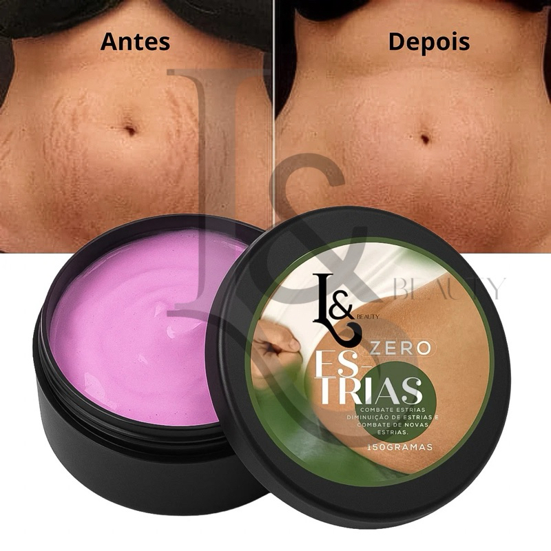 Creme Zero Estrias Removedor Anti Estrias Trata E Previne 150g - L&Beauty | Shopee Brasil
