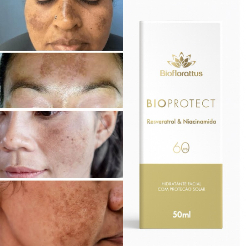 Protetor Solar FPS 60 Bioprotect | Melasma; Manchas de sol | BIOFLORATTUS | Shopee Brasil