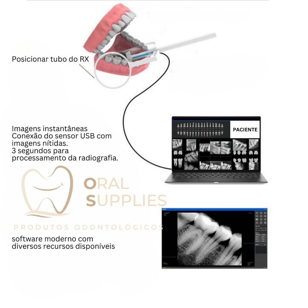 sensor digital de raio x | Shopee Brasil