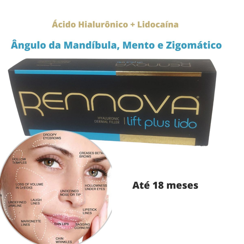 PREENCHEDOR RENNOVA LIFT PLUS LIDO ÁCIDO HIALURÔNICO LIDOCAÍNA VOLUMIZADOR | Shopee Brasil
