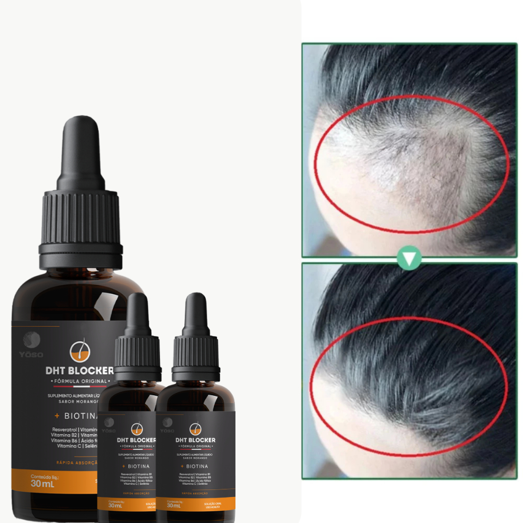 3 DHT Blocker Original p/ Tratamento Capilar queda de cabelo mega ...