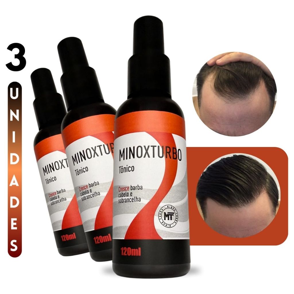 Tonico Original Crescimento Cabelo Barba Nasce Fios Novos 120ml ...