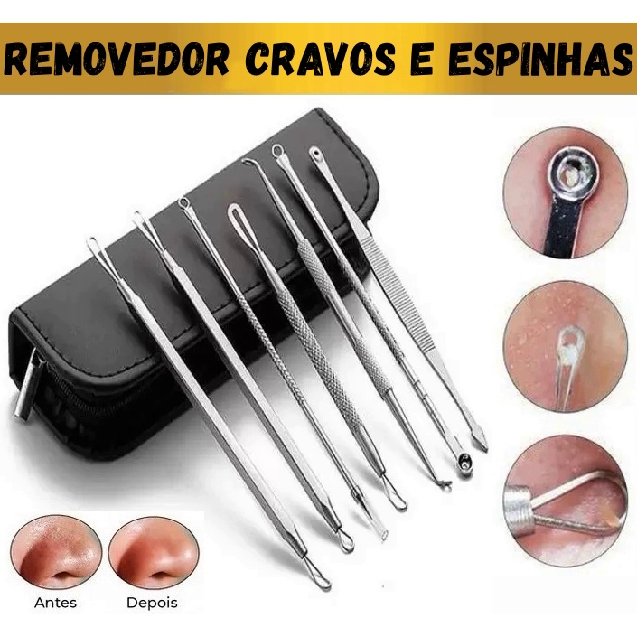 Extrator De Cravo Espinha Profissional Em Inox 7 Peças Pronta Entrega ...
