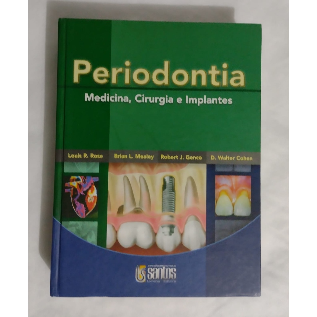 Periodontia - Medicina, Cirurgia e Implante | Shopee Brasil