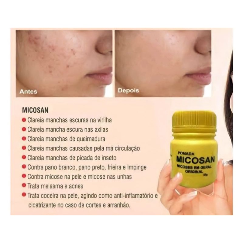 Micosan Pomada combate Micoses Em Geral Clareia Manchas na pele ...