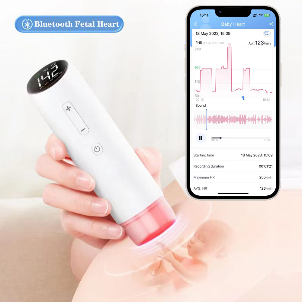 Monitor De Carga Bluetooth Doppler Fetal Ultrasonido Bebê Grávida ...