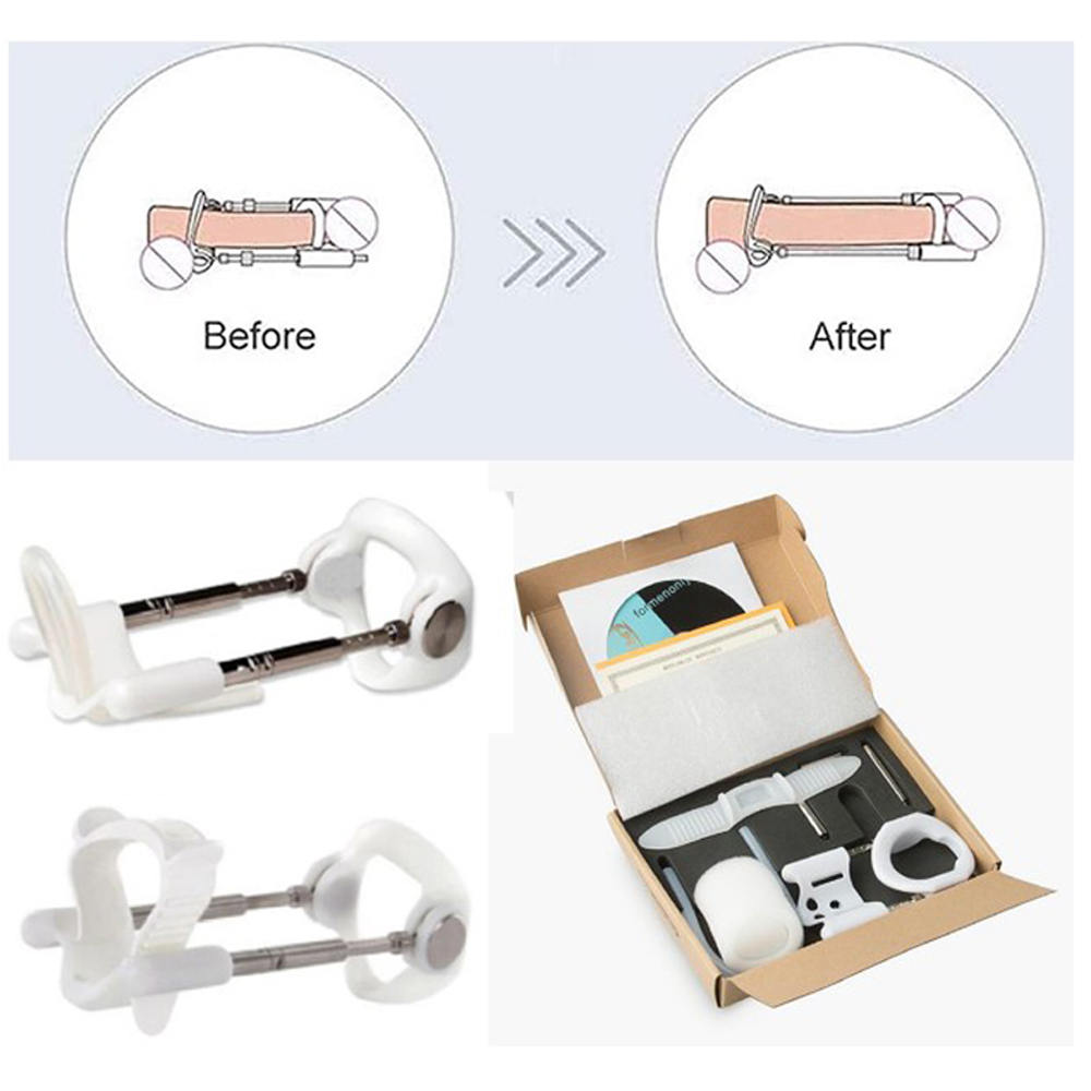 Pro Extensor 3rd Para Penis Extender Masculino Divisão Ampliar Borda ...